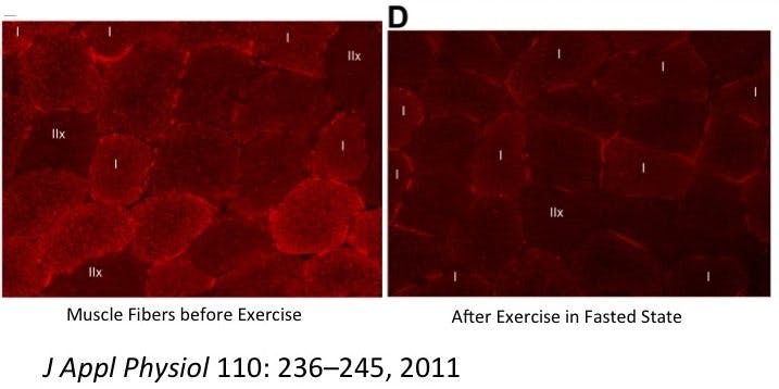 Fasting and exercise - Diet Doctor