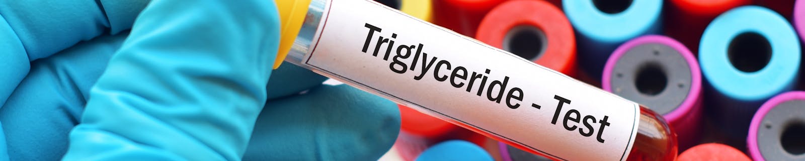 How to Lower Triglycerides - Diet Doctor