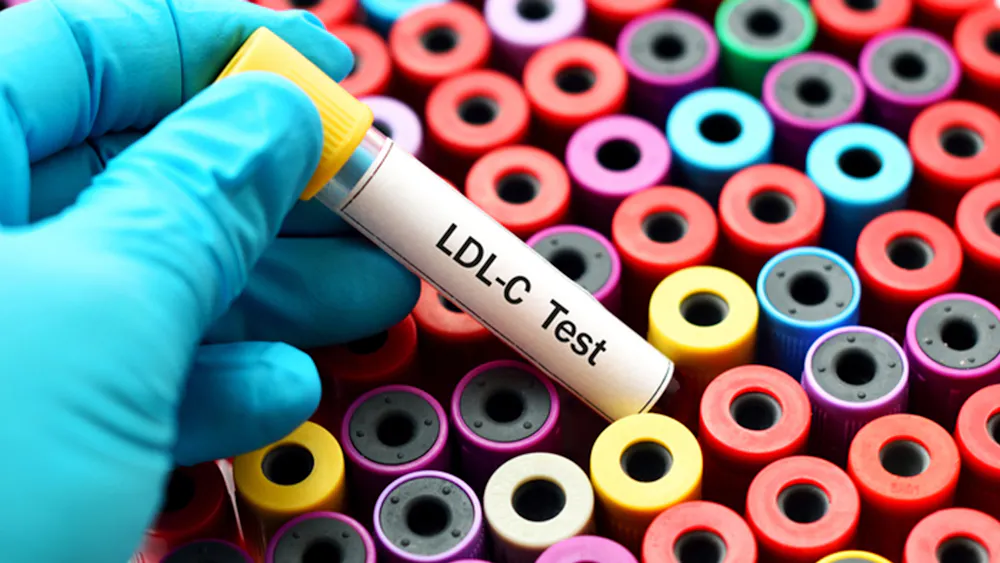 Is elevated LDL cholesterol harmful? — Diet Doctor