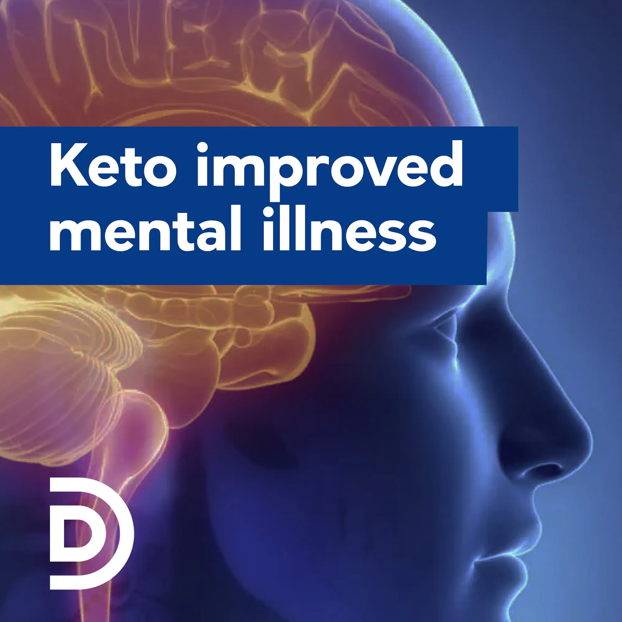 Top 5 Diet Doctor resources on diet and mental health – Diet Doctor